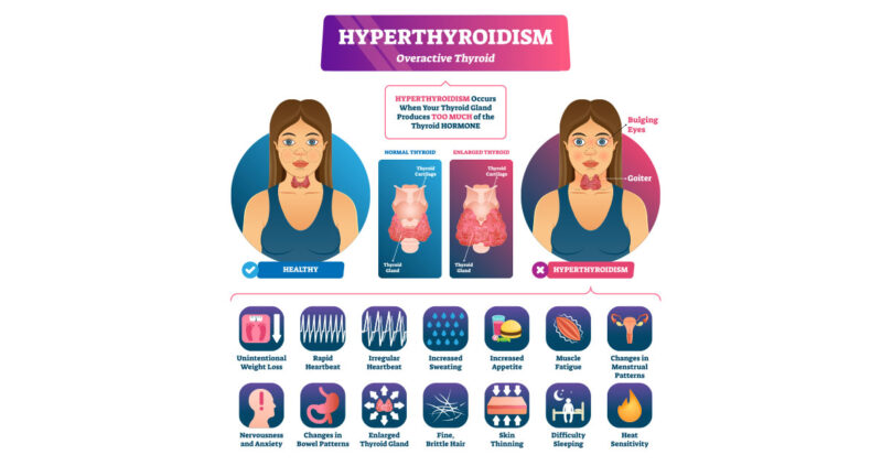 Ano nga ba ang Hyperthyroidism? - Medchoice